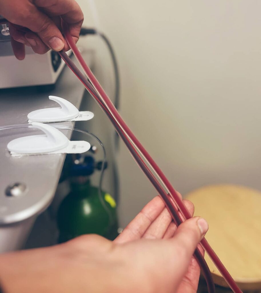 EBOO Therapy | Vitalis Health