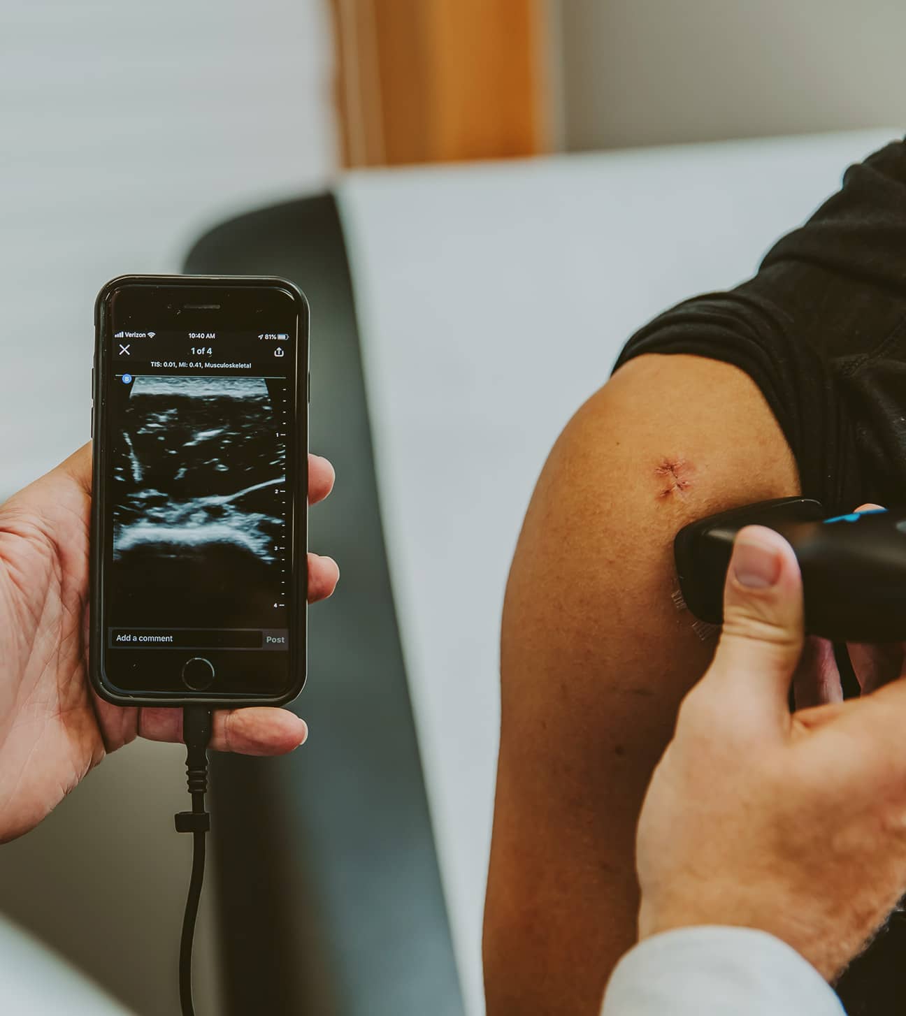 Joint Injections | Vitalis Health